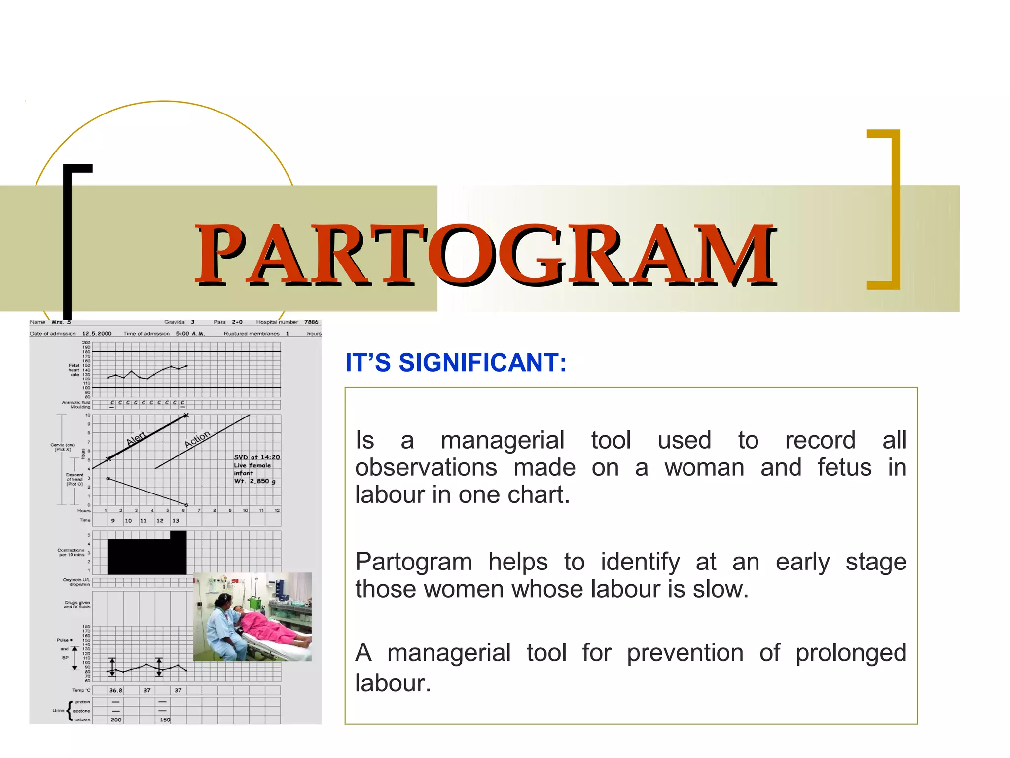 Partogram | PPT