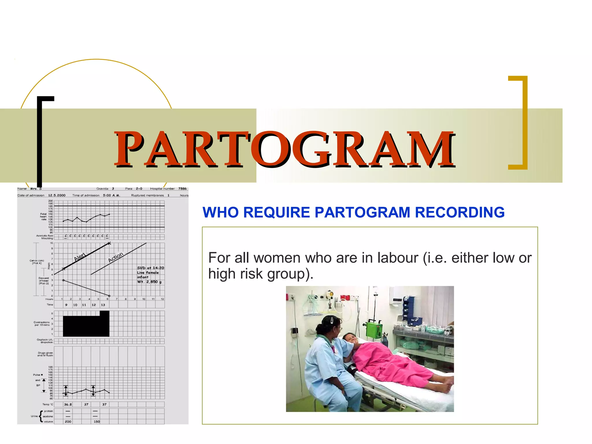 Partogram | PPT