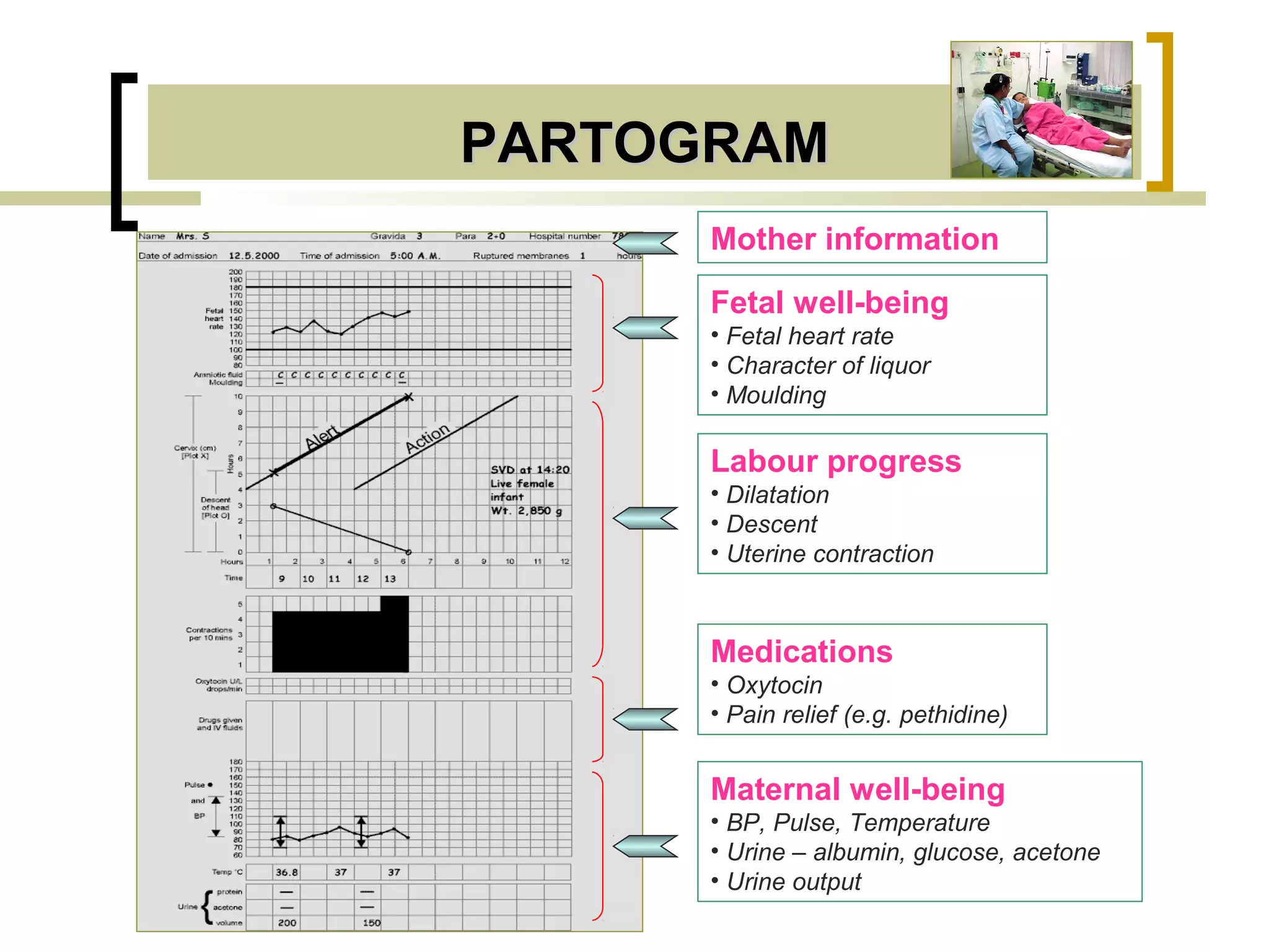 Partogram | PPT