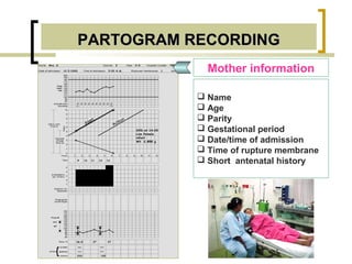 Partogram | PPT