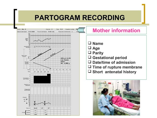 Partogram | PPT | Pregnancy | Reproductive Health
