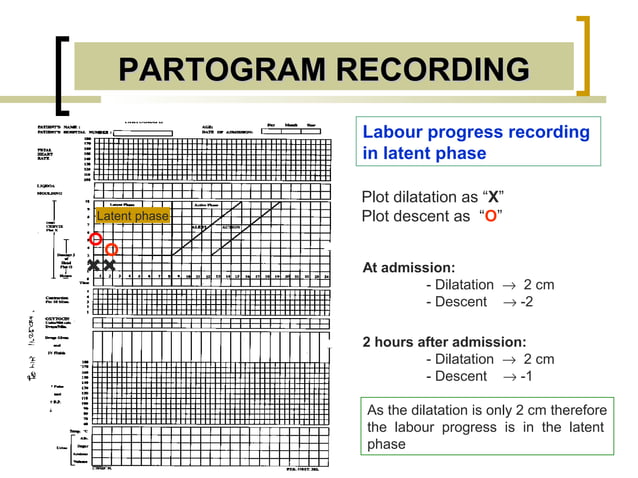 Partogram | PPT | Pregnancy | Reproductive Health