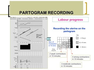 Partogram | PPT