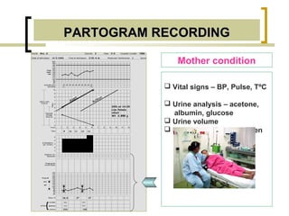 Partogram | PPT