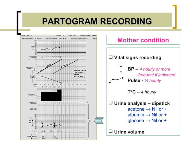 Partogram | PPT | Pregnancy | Reproductive Health