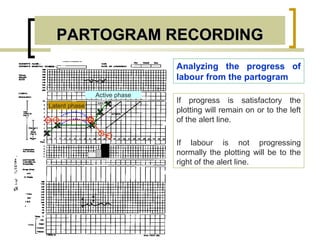 Partogram | PPT