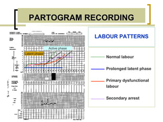 Partogram | PPT