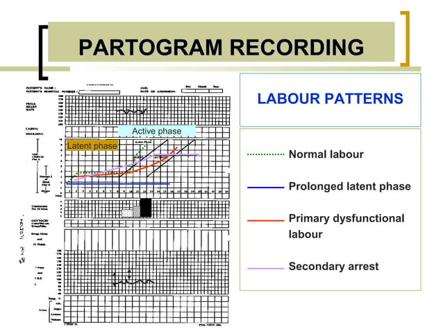 Partogram | PPT | Pregnancy | Reproductive Health