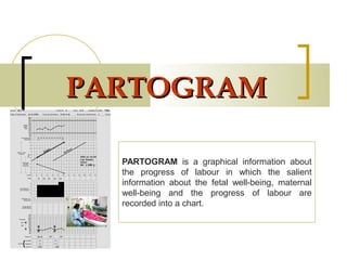 Partogram | PPT