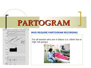 Partogram | PPT | Pregnancy | Reproductive Health