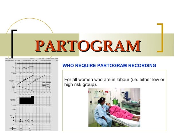 Partogram | PPT | Pregnancy | Reproductive Health