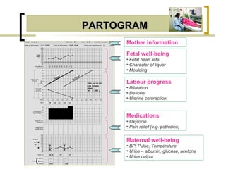 Partogram | PPT