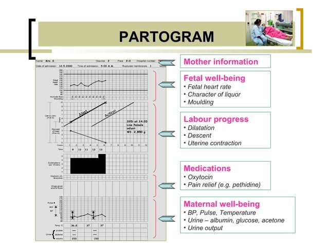 Partogram | PPT | Pregnancy | Reproductive Health