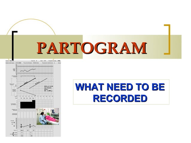 Partogram | PPT | Pregnancy | Reproductive Health