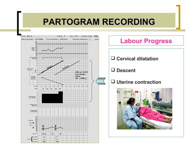 Partogram | PPT