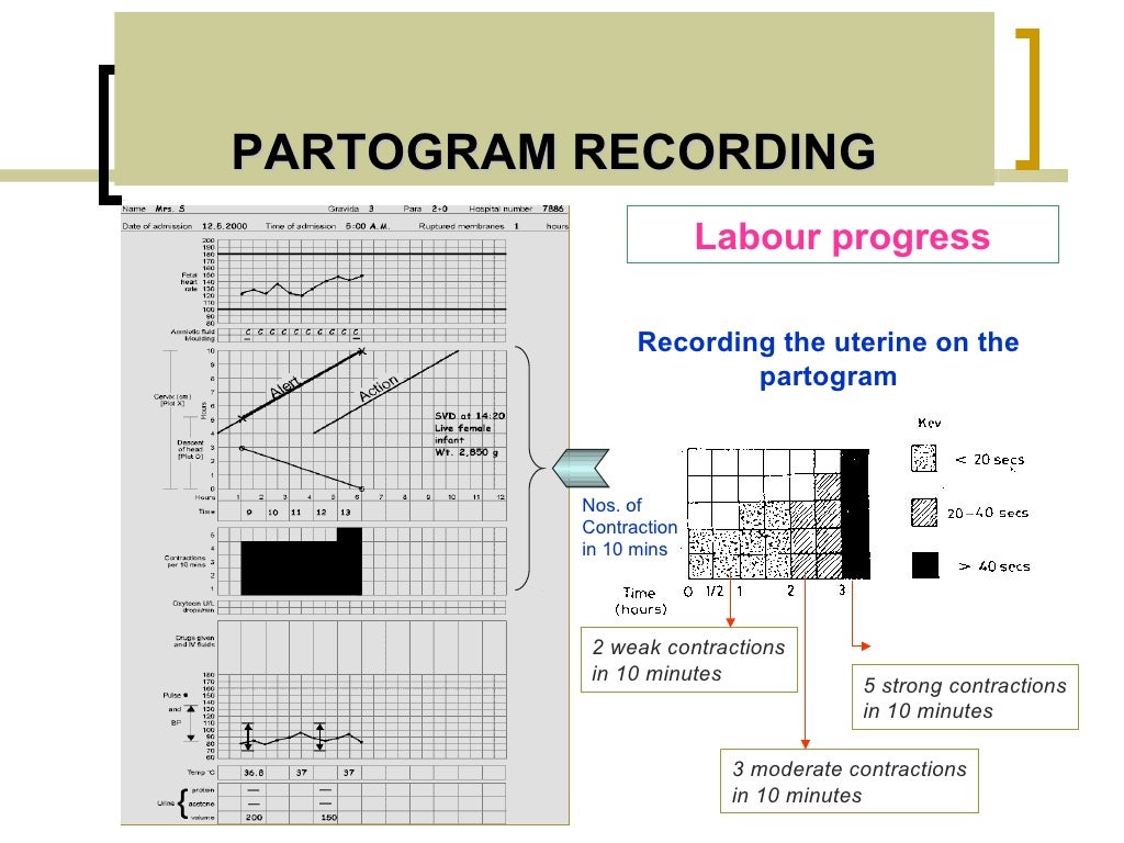 Partogram