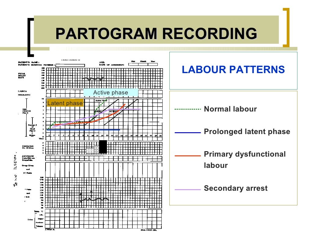 Partogram