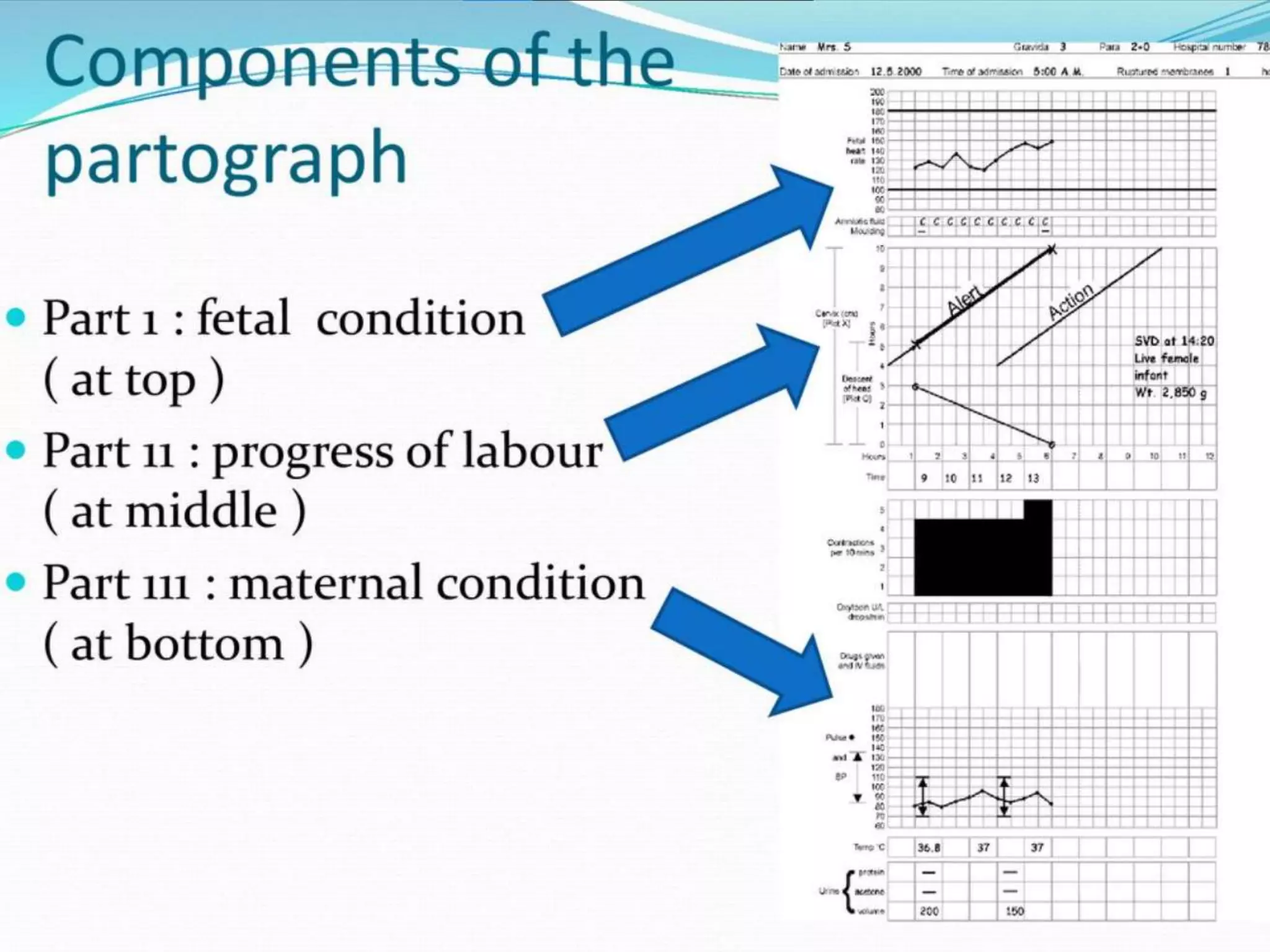 PARTOGRAM.pptx | Pregnancy | Reproductive Health
