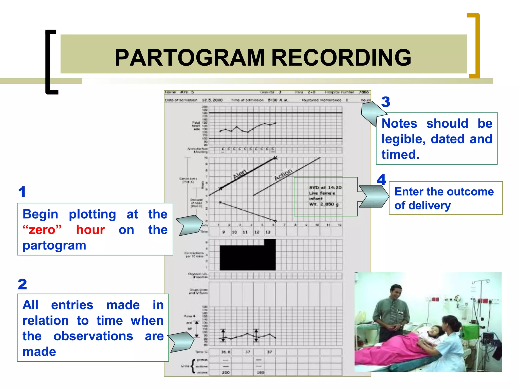 PARTOGRAM.pptx
