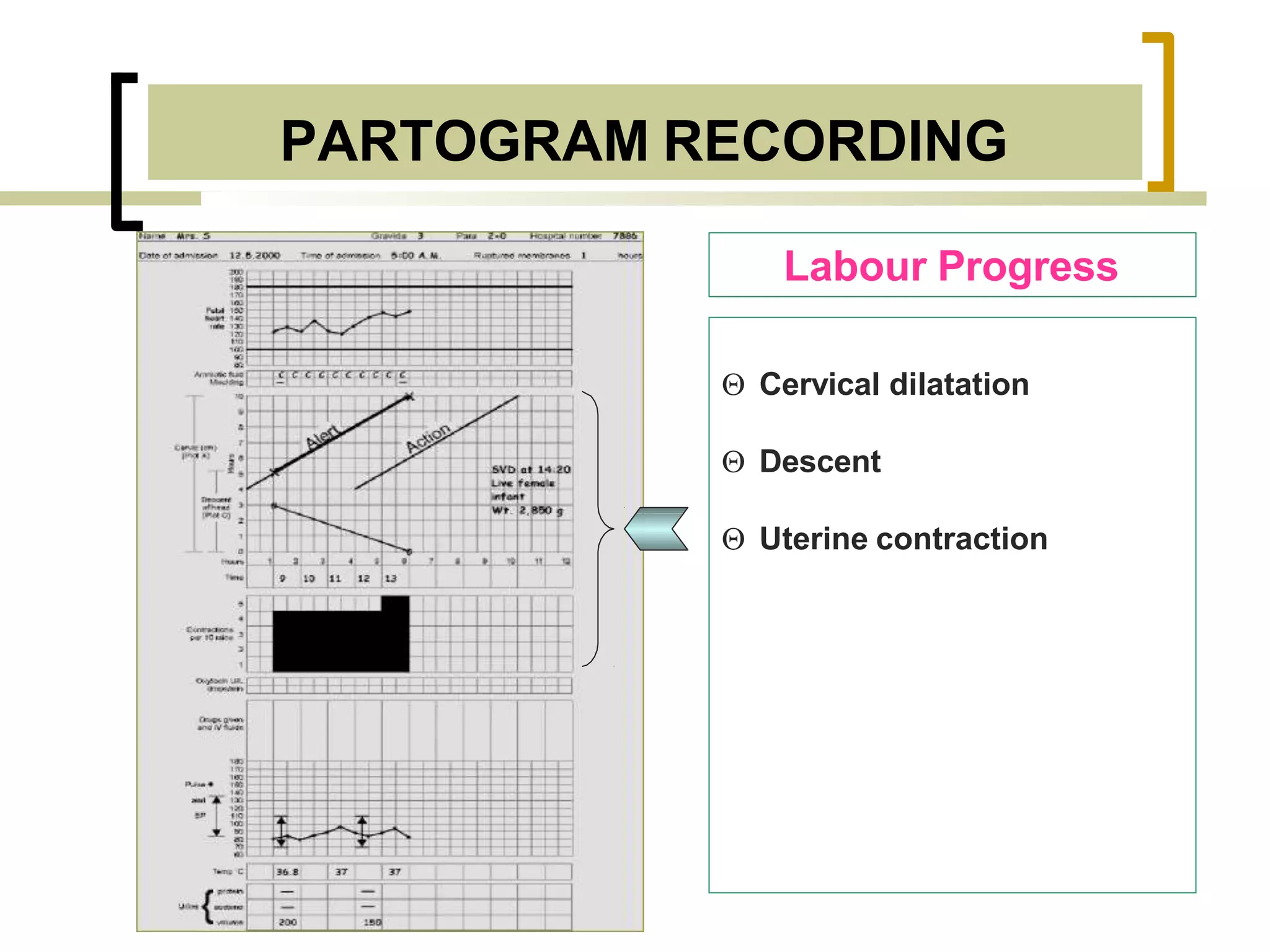 PARTOGRAM.pptx | Pregnancy | Reproductive Health