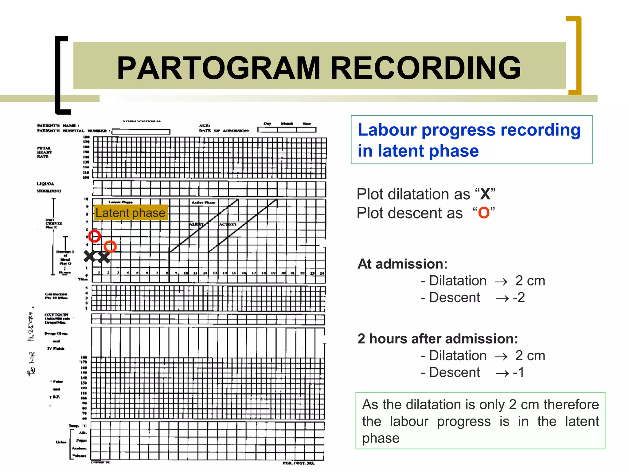PARTOGRAM.pptx