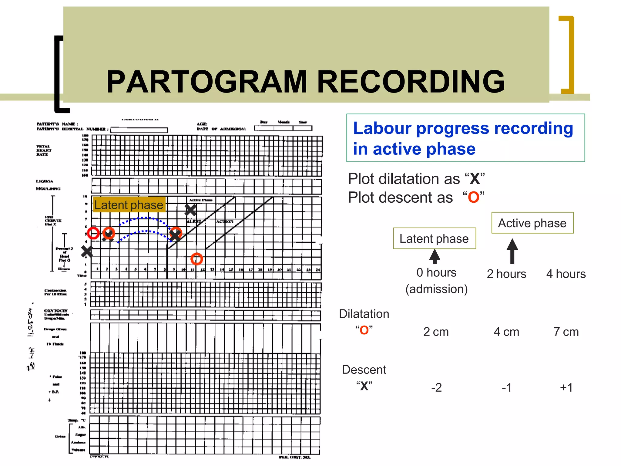 PARTOGRAM.pptx