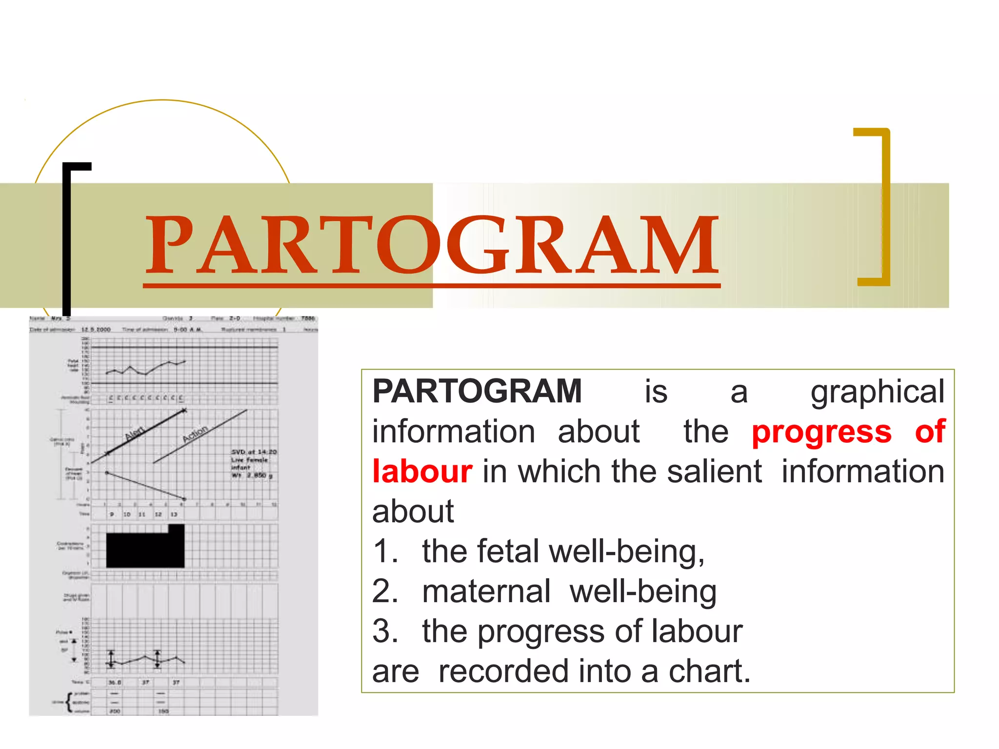 PARTOGRAM.pptx | Pregnancy | Reproductive Health