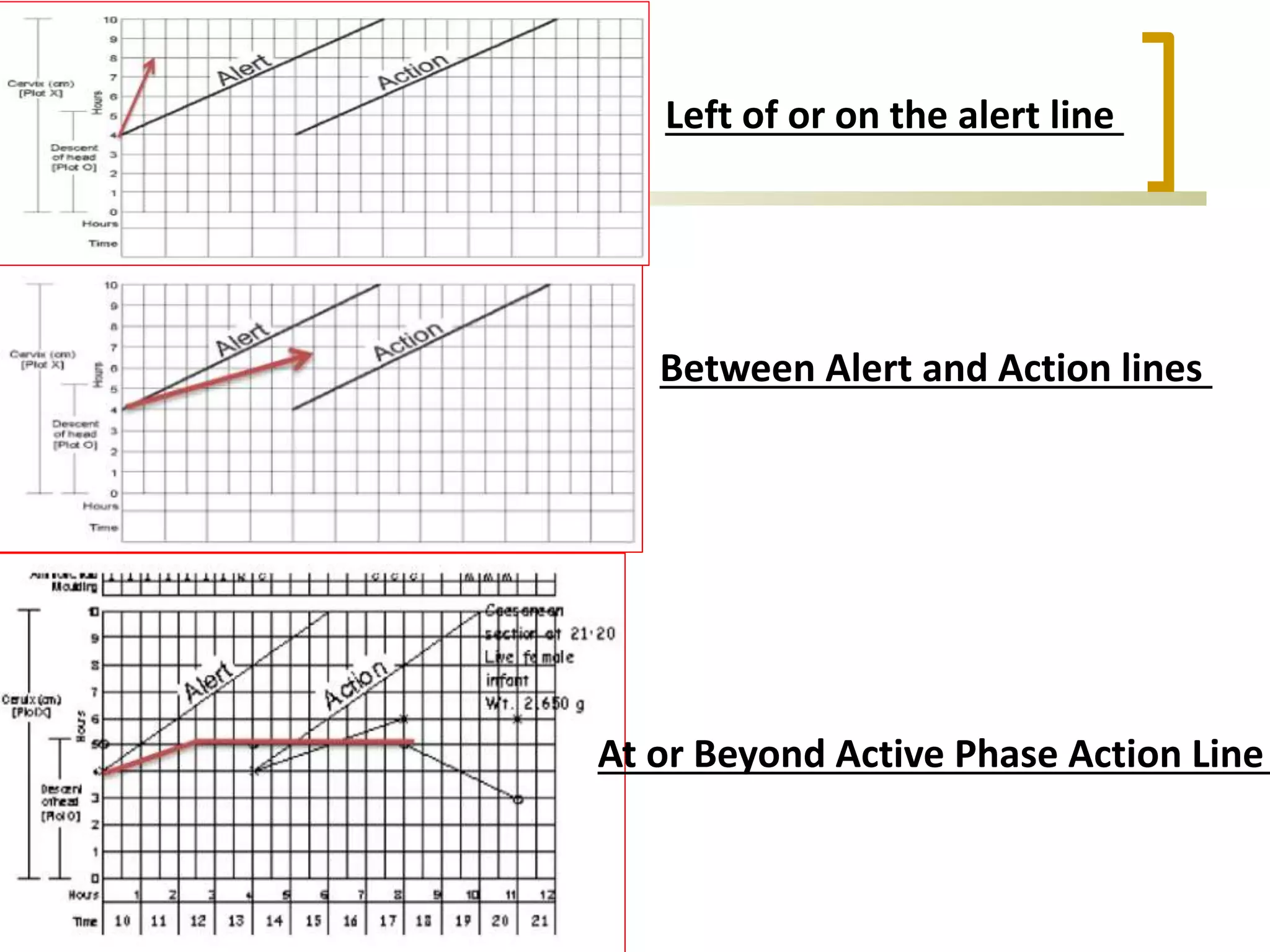 PARTOGRAM.pptx | Pregnancy | Reproductive Health