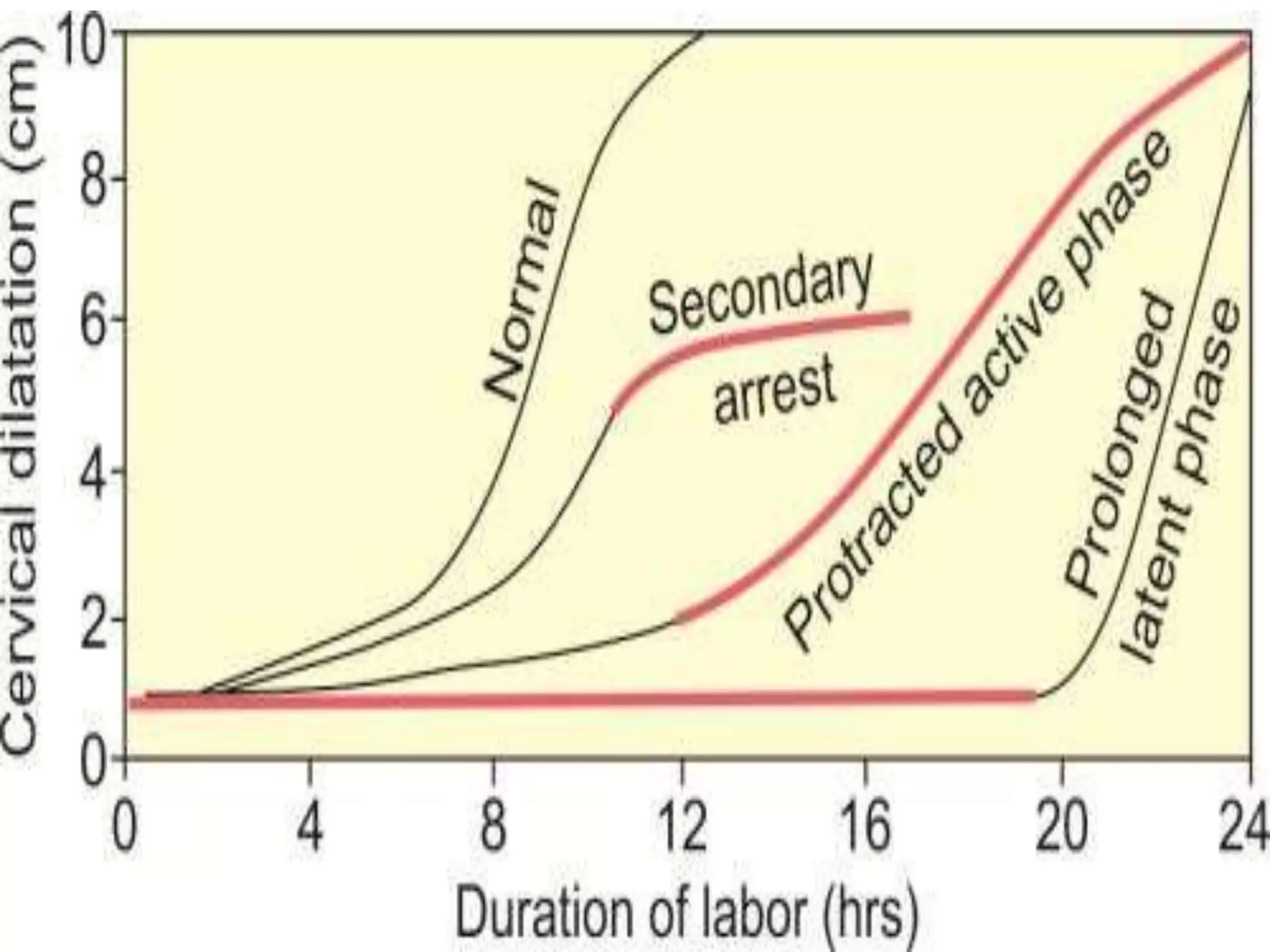 PARTOGRAM.pptx | Pregnancy | Reproductive Health