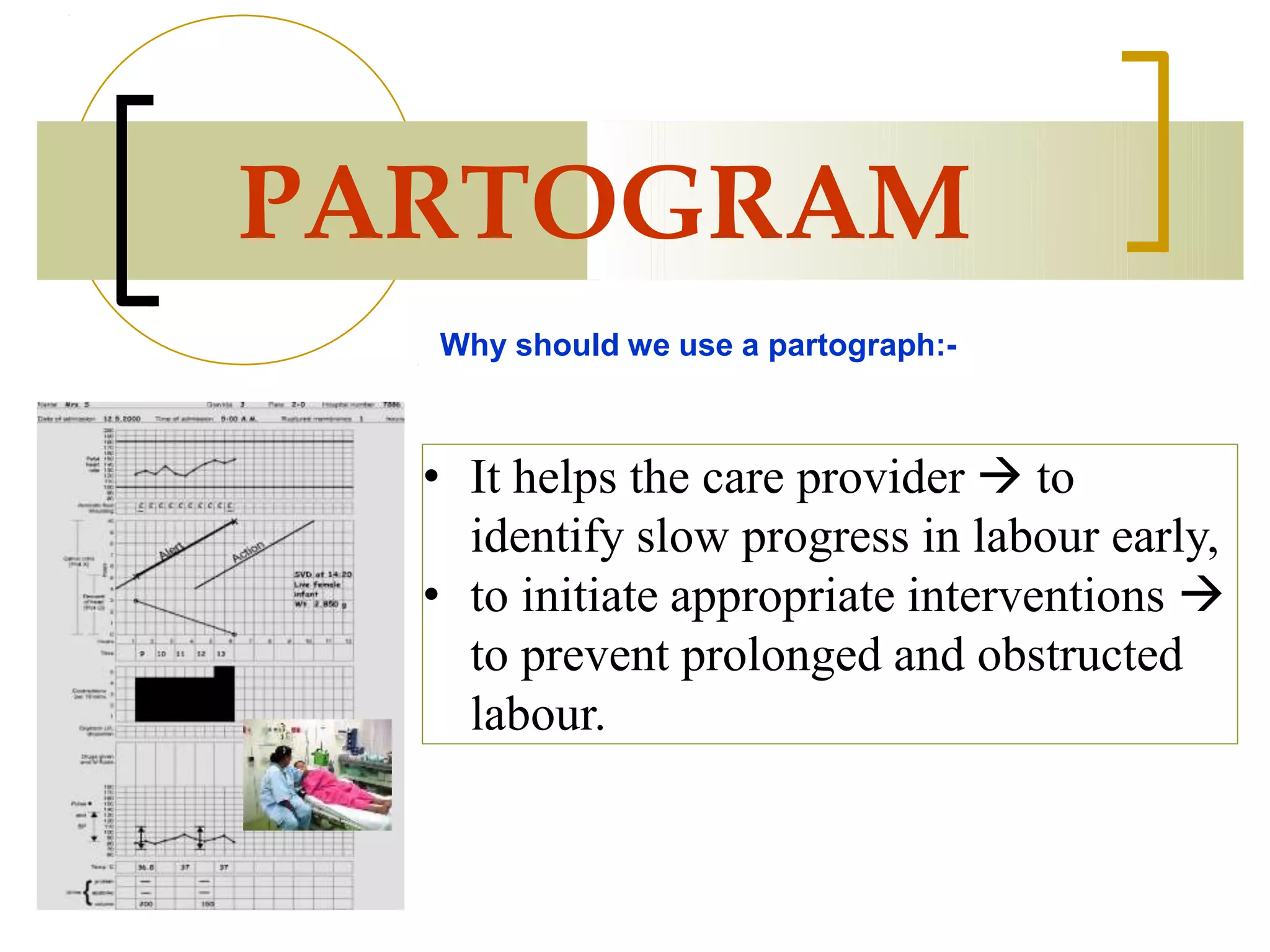 PARTOGRAM.pptx