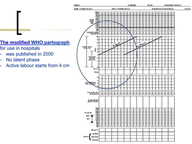 PARTOGRAM.pptx | Pregnancy | Reproductive Health