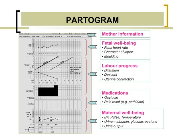 PARTOGRAM.pptx | Pregnancy | Reproductive Health