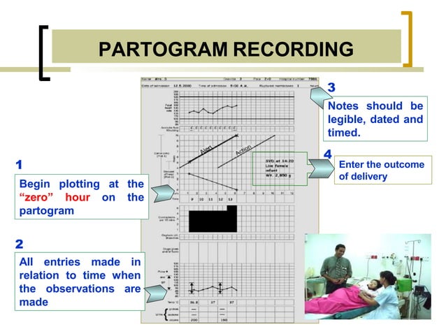 PARTOGRAM.pptx | Pregnancy | Reproductive Health