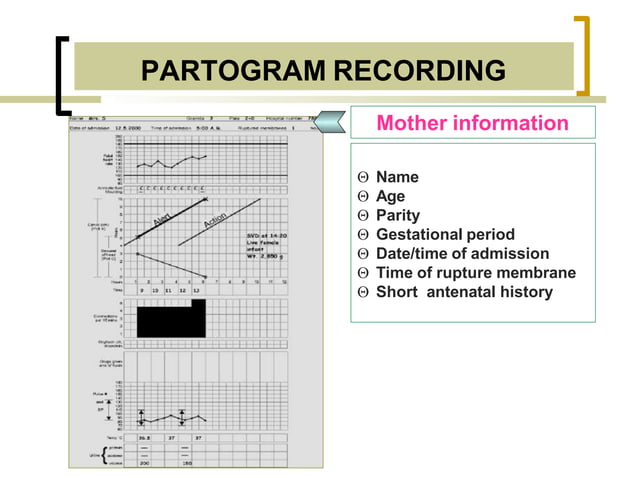PARTOGRAM.pptx | Pregnancy | Reproductive Health