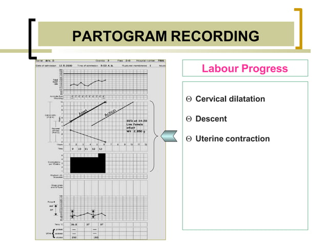 PARTOGRAM.pptx | Pregnancy | Reproductive Health