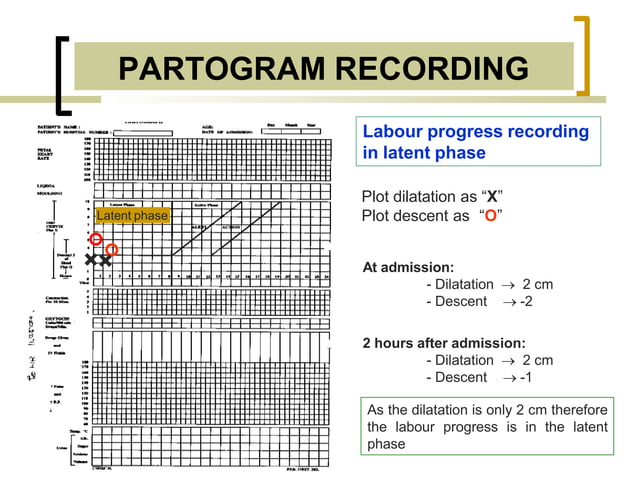 PARTOGRAM.pptx | Pregnancy | Reproductive Health