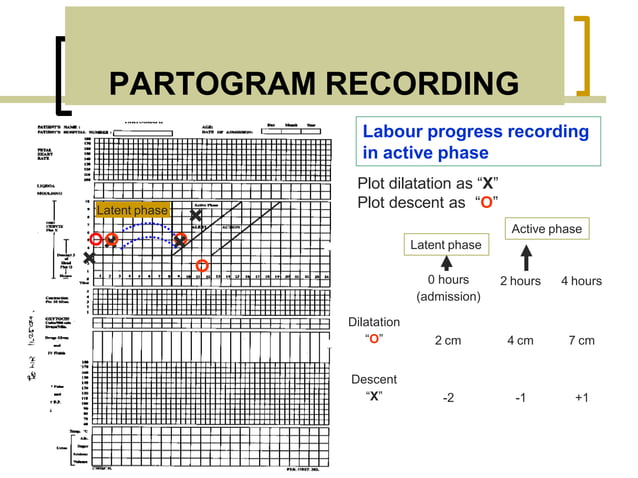 PARTOGRAM.pptx | Pregnancy | Reproductive Health