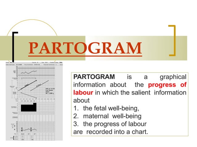 PARTOGRAM.pptx | Pregnancy | Reproductive Health