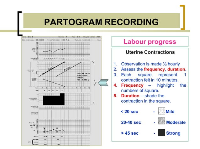 PARTOGRAM.pptx | Pregnancy | Reproductive Health