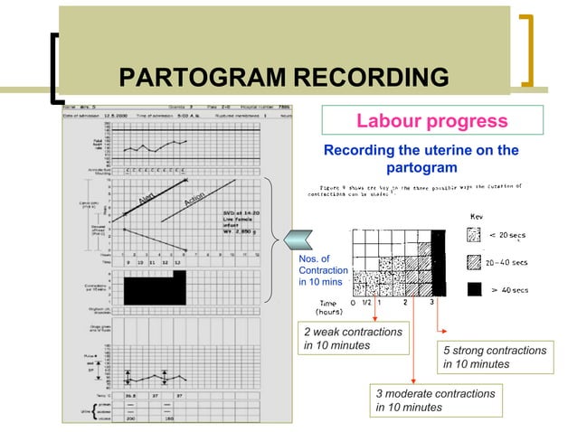 PARTOGRAM.pptx | Pregnancy | Reproductive Health