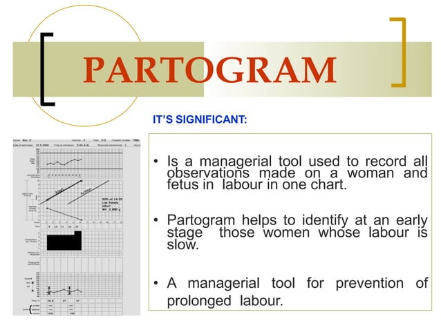 PARTOGRAM.pptx | Pregnancy | Reproductive Health