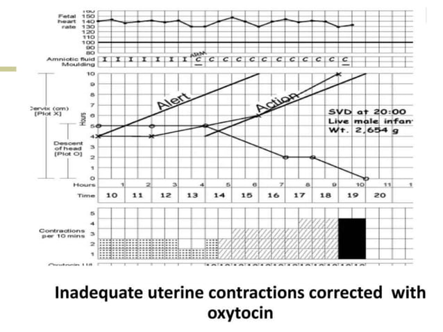 PARTOGRAM.pptx | Pregnancy | Reproductive Health