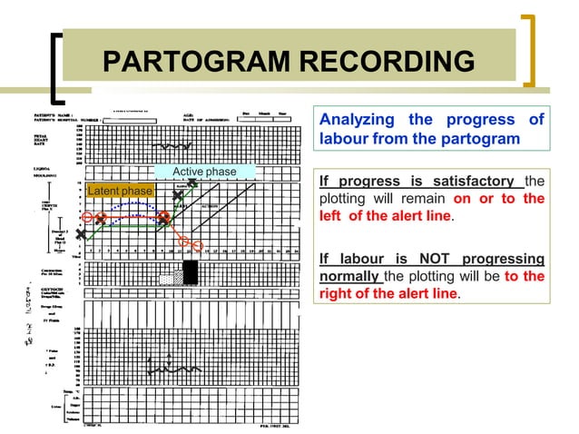PARTOGRAM.pptx | Pregnancy | Reproductive Health