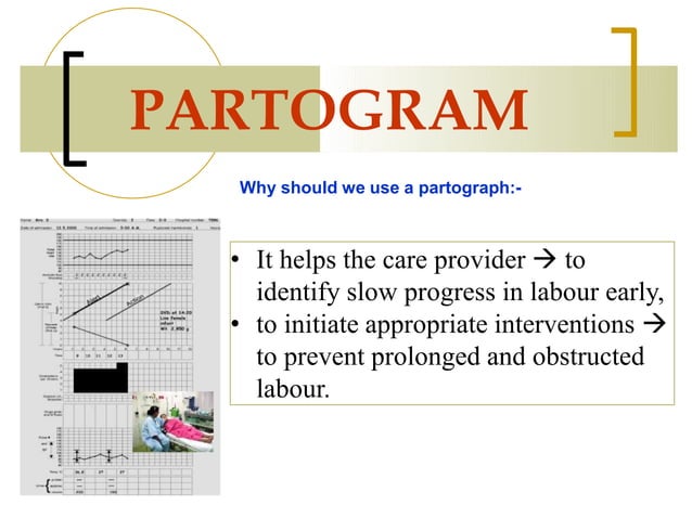 PARTOGRAM.pptx | Pregnancy | Reproductive Health