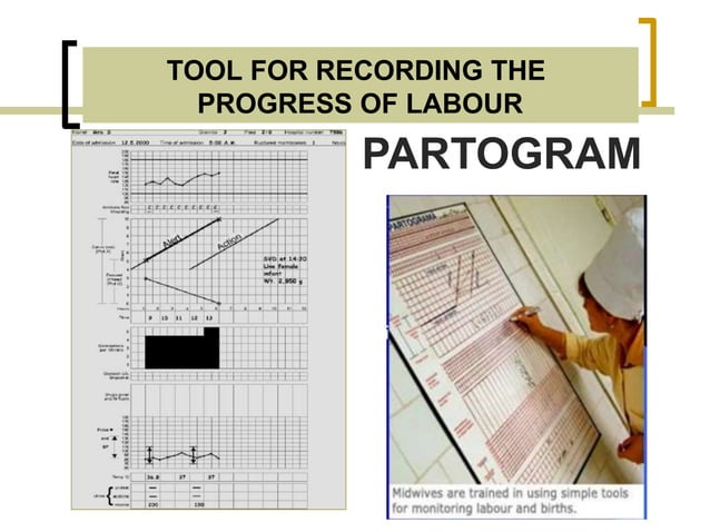 PARTOGRAM.pptx | Pregnancy | Reproductive Health