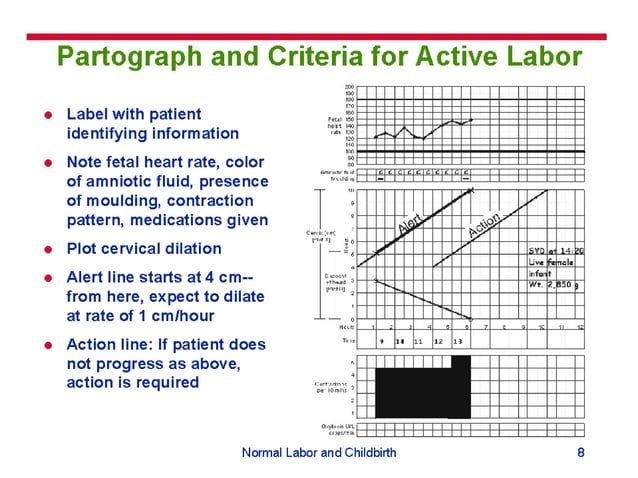 Partogram.ppt its components role of nurse while using partogram ...