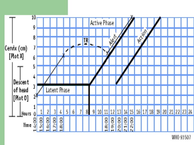 Partogram.ppt its components role of nurse while using partogram ...
