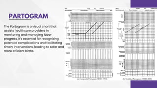 Partogram :a tool for labor minitoring.pdf