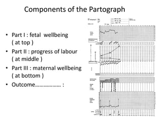 Partogram-kck.ppt