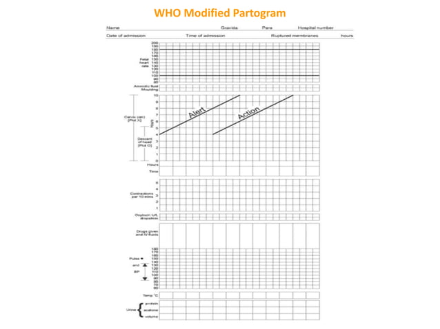 Partogram-kck.ppt